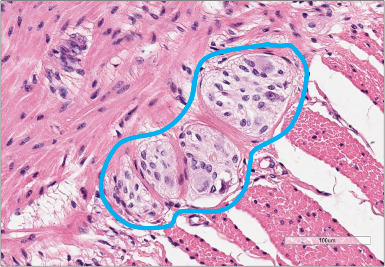 Laser Microdissection法 - Axcelead Drug Discovery Partners株式会社